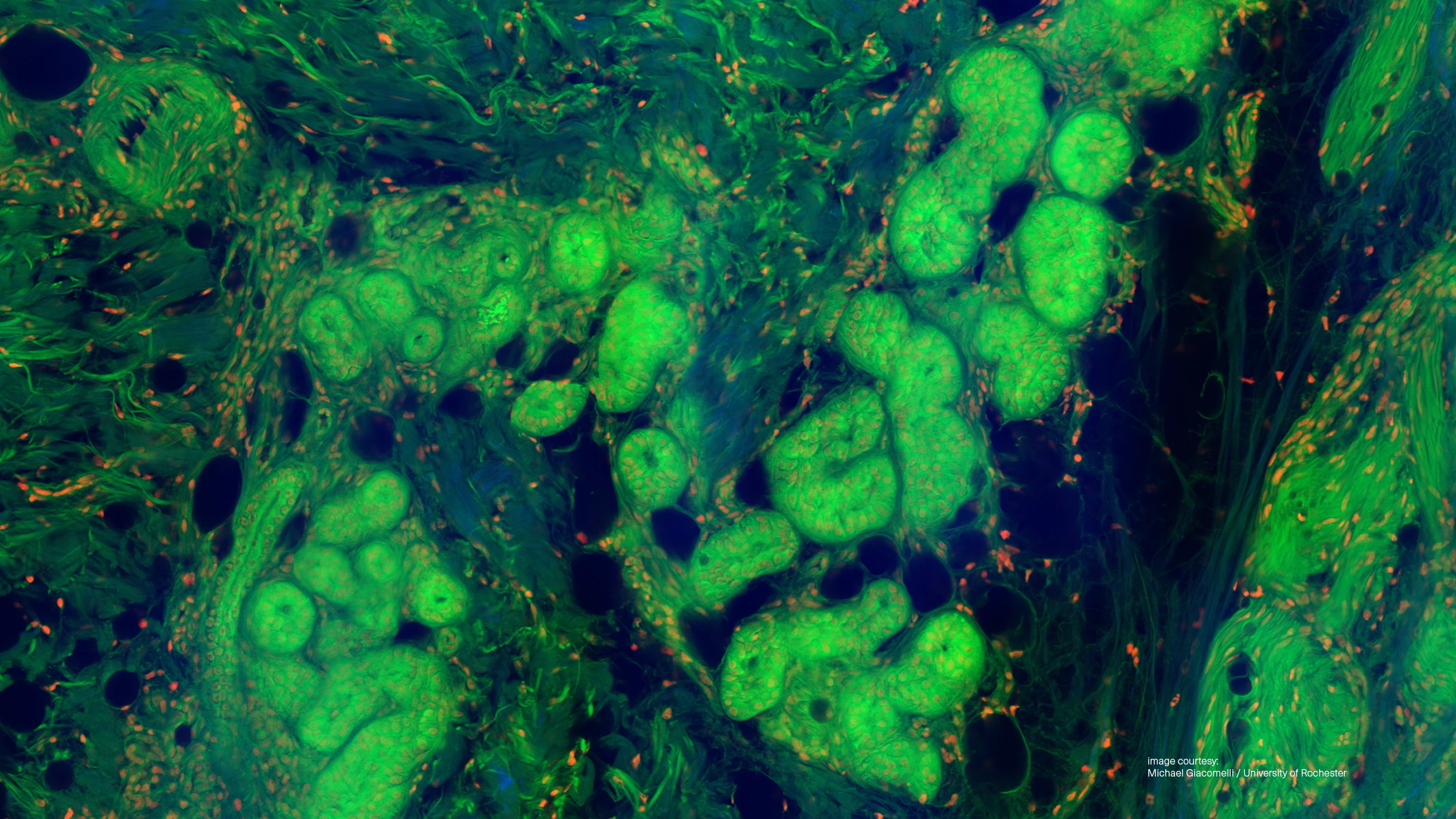 Super Resolution Microscopy (STED, SIM, PALM, STORM)
